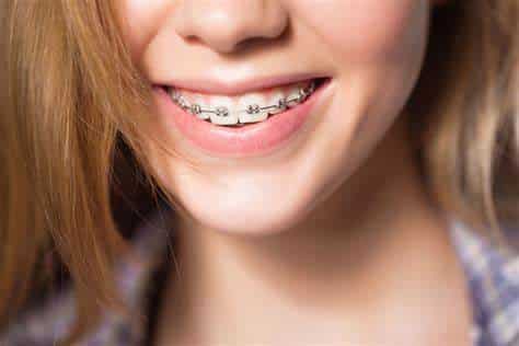 Signs You May Need Braces (Even as an Adult) - Zaidi Orthodontics